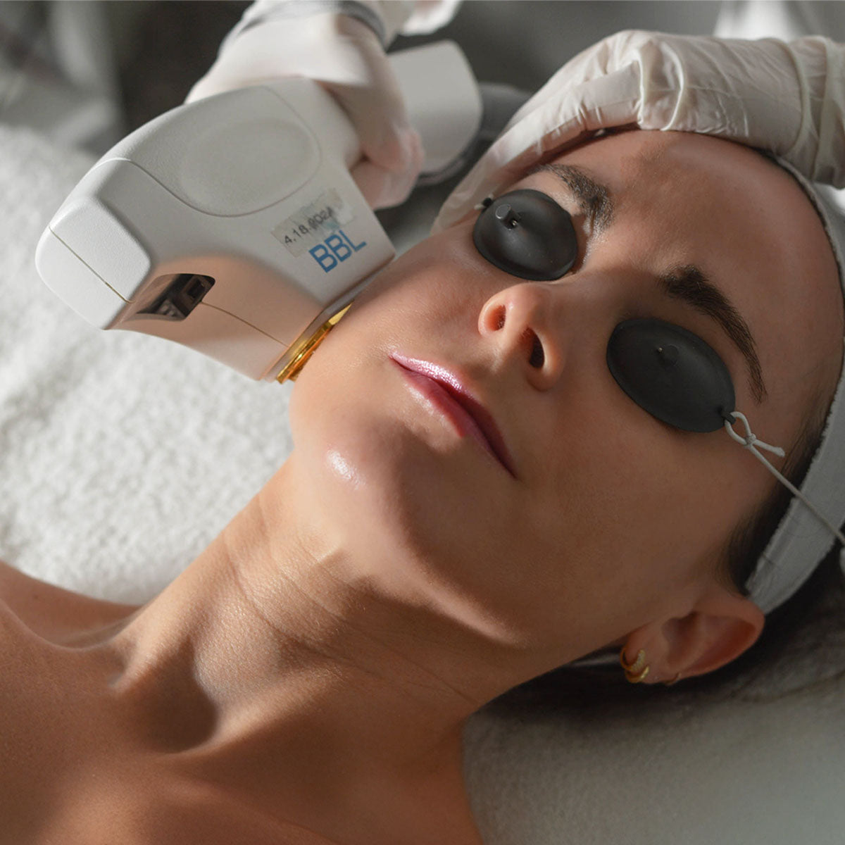 Forever Young Facial – Skin Rejuvenation & Age Spot Removal | Rescue Spa